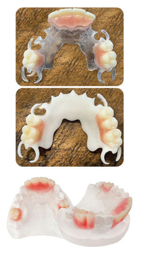 Partials - Classic Craft Dental Lab