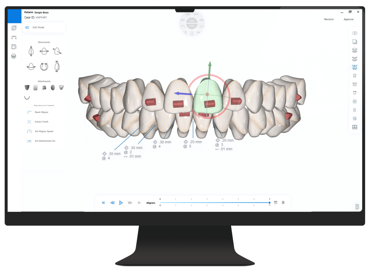 Clear Aligners - Classic Craft Dental Lab